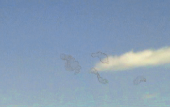 Facts About Floaters - Southside Eye Care